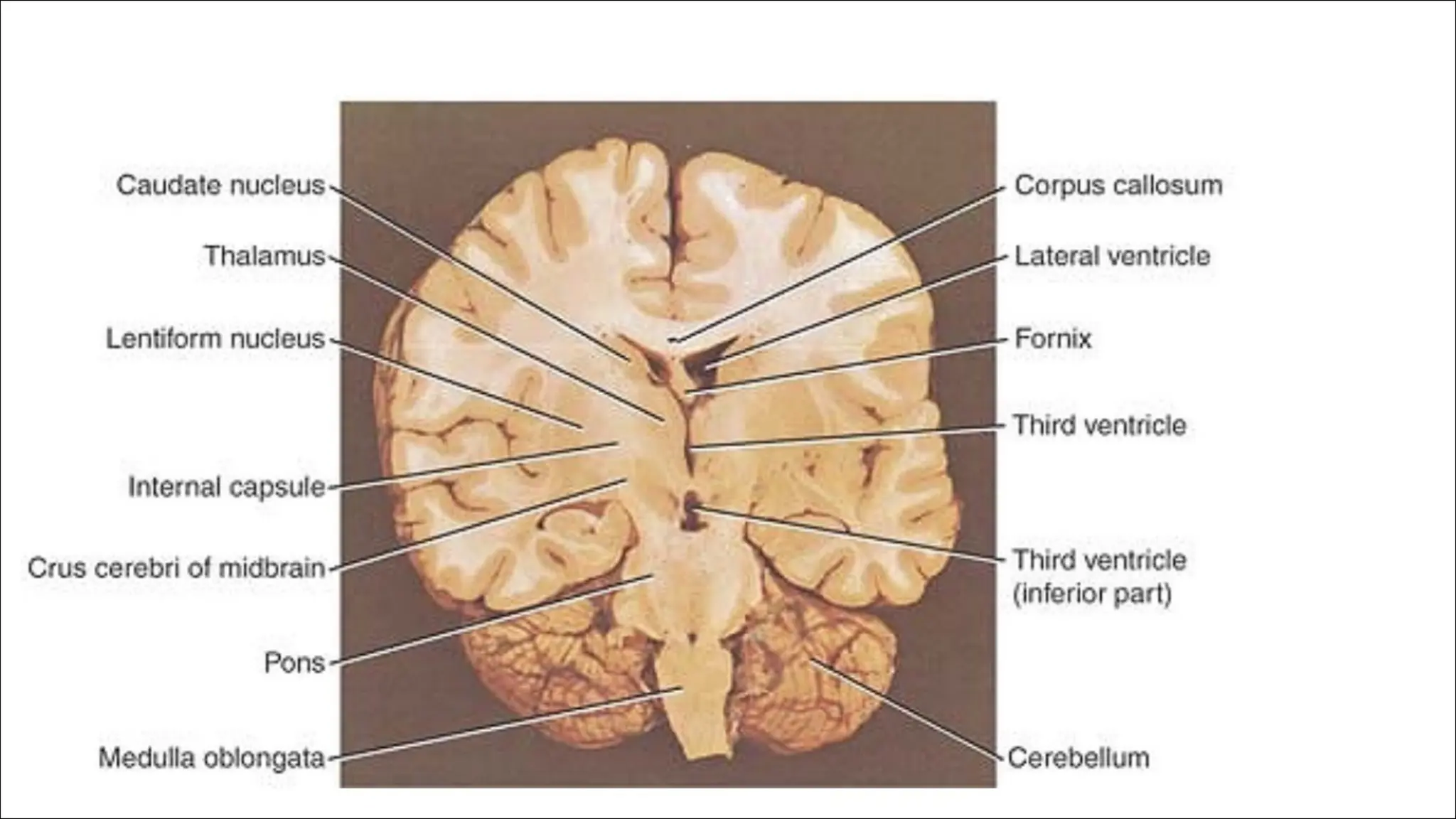 Gross-Anatomy-of-the-Nervous-System-lecture.pdf