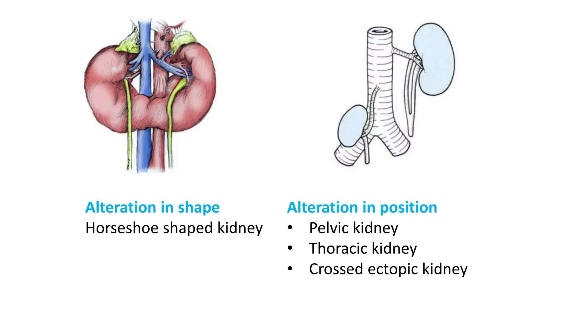 Gross anatomy and Histology of urinary system. | PDF