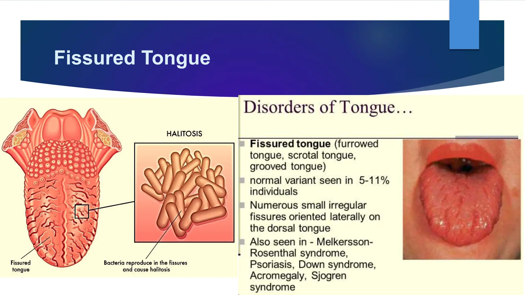 Gross Anatomy and Histology of Tongue by Dr. Rabia Inam Gandapore.pptx ...