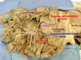 Gross anatomy & histology of ileum, jejunum | PPT