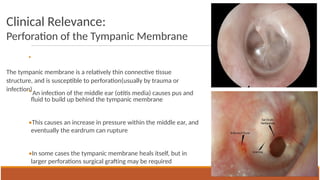GROSS ANATOMY OF EAR along with clinicals | PPTX
