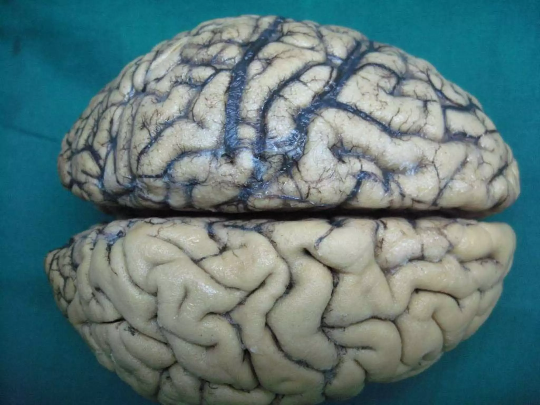 Gross anatomy of human brain | PPT