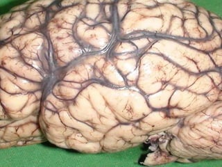 Gross anatomy of human brain | PPT