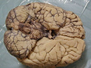 Gross anatomy of human brain | PPT