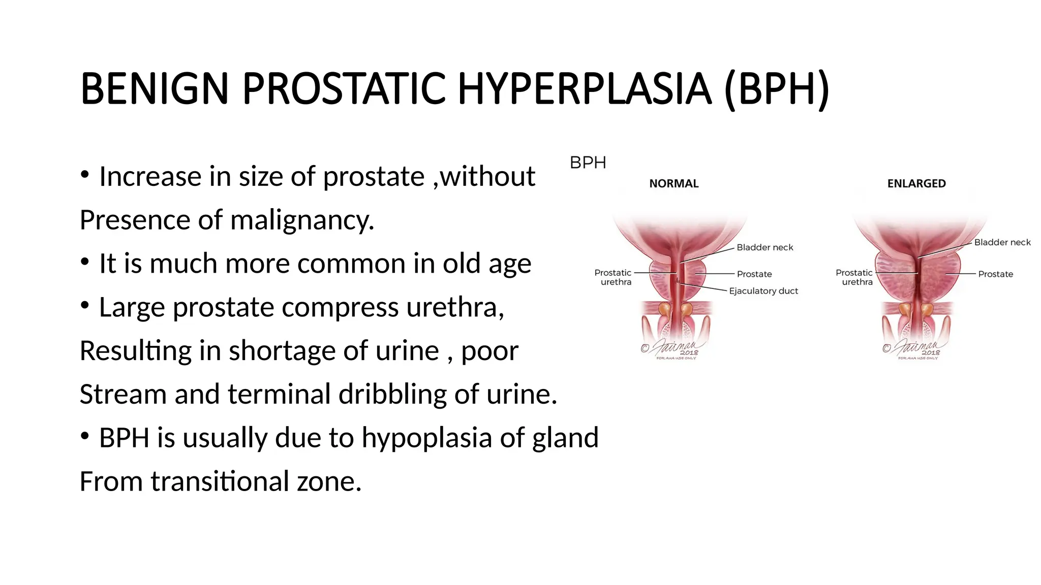 GROSS ANATOMY OF PROSTATE GLAND WITH CLINICALS (1).pptx