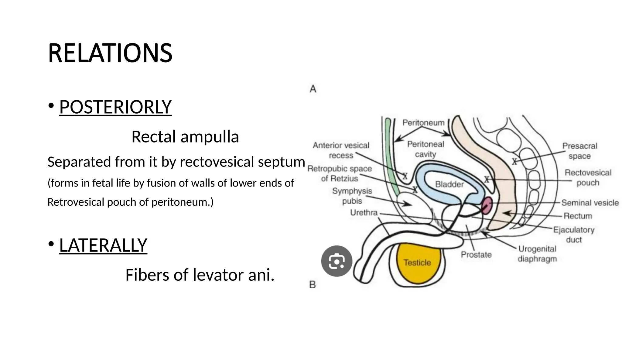 GROSS ANATOMY OF PROSTATE GLAND WITH CLINICALS (1).pptx