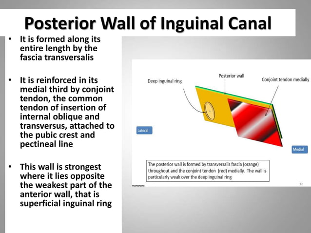 GROSS ANATOMY OF THE INGUINAL CANAL.ppt | Death, Injury, or Military ...