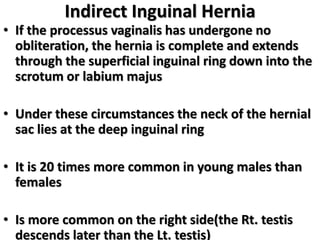 GROSS ANATOMY OF THE INGUINAL CANAL.ppt