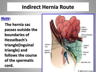 GROSS ANATOMY OF THE INGUINAL CANAL.ppt