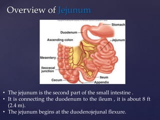 Gross anatomy of the jejunum , including blood and nerve supply, venous ...