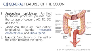 Appendices Epiploicae