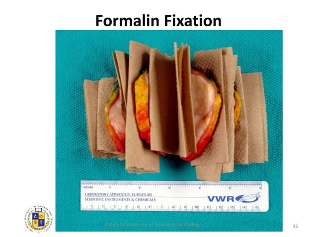 Grossing.pptx | Infectious Diseases | Diseases and Conditions