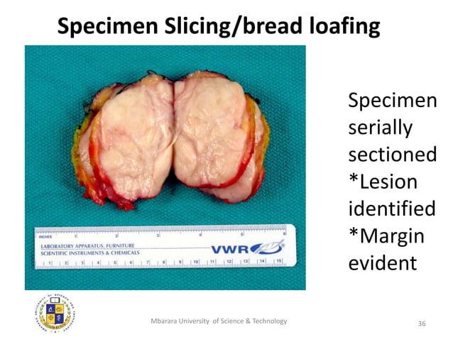 Grossing.pptx | Infectious Diseases | Diseases and Conditions