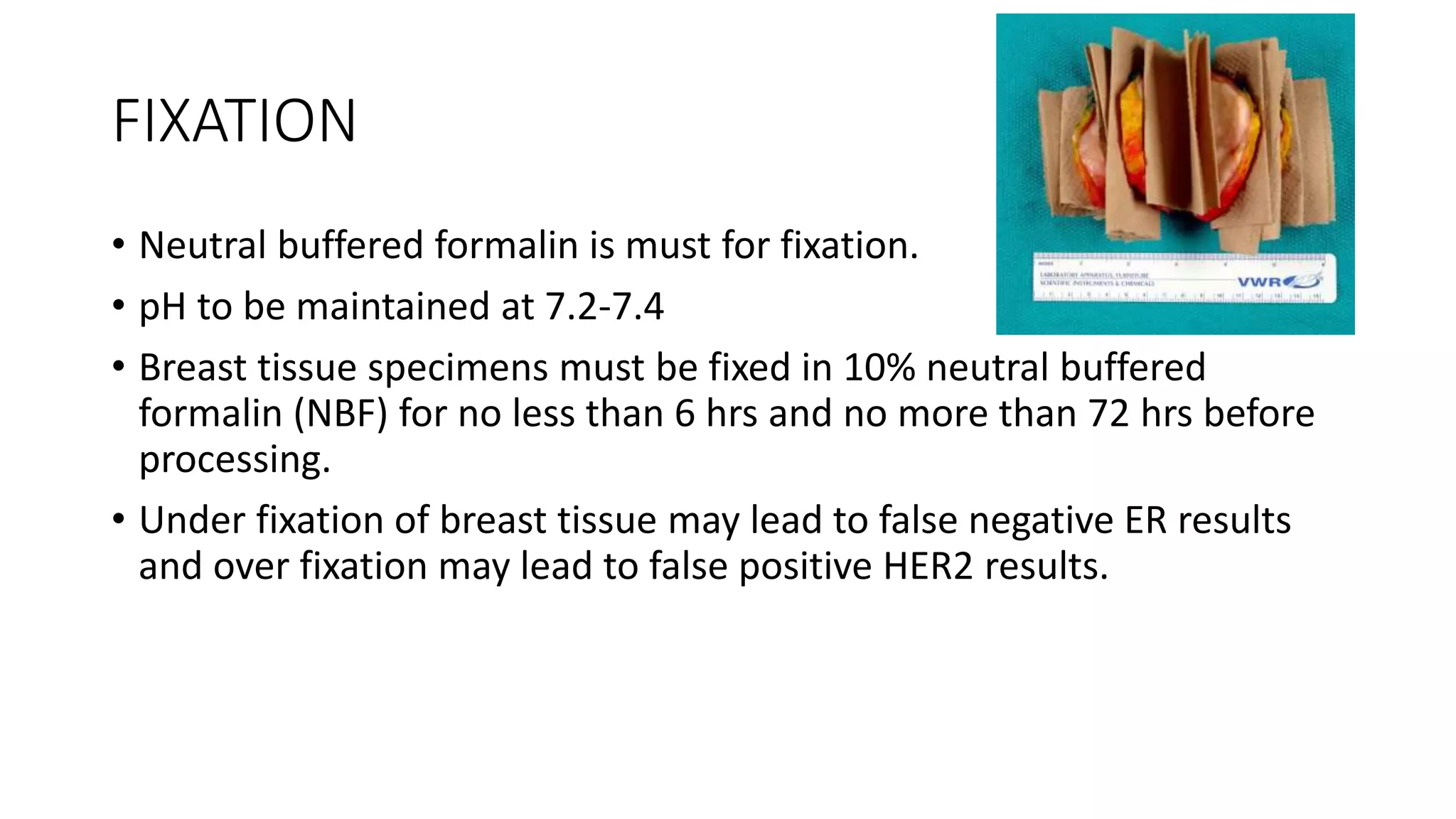 GROSSING OF BREAST.pptx