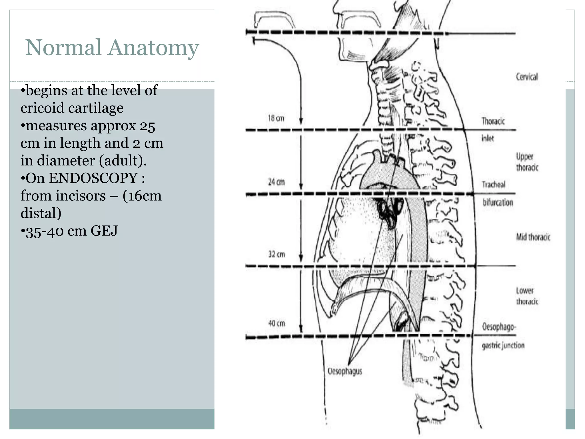 Grossing of esophagus | PPTX