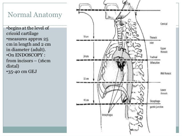 Grossing of esophagus