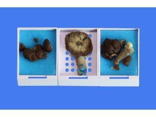Grossing of Gastrointestinal specimens | PPTX