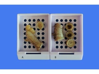 Grossing of Gastrointestinal specimens | PPTX