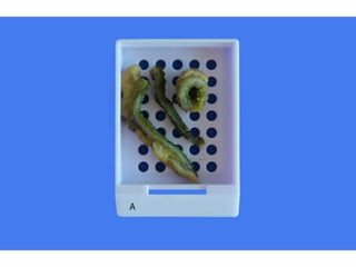 Grossing of Gastrointestinal specimens | PPTX