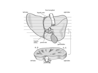 Grossing of Gastrointestinal specimens | PPTX