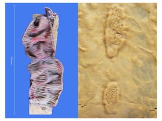 Grossing of Gastrointestinal specimens | PPTX