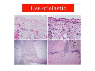 Grossing of Gastrointestinal specimens | PPTX