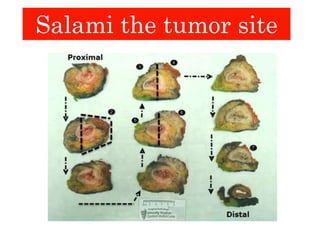 Grossing of Gastrointestinal specimens | PPTX