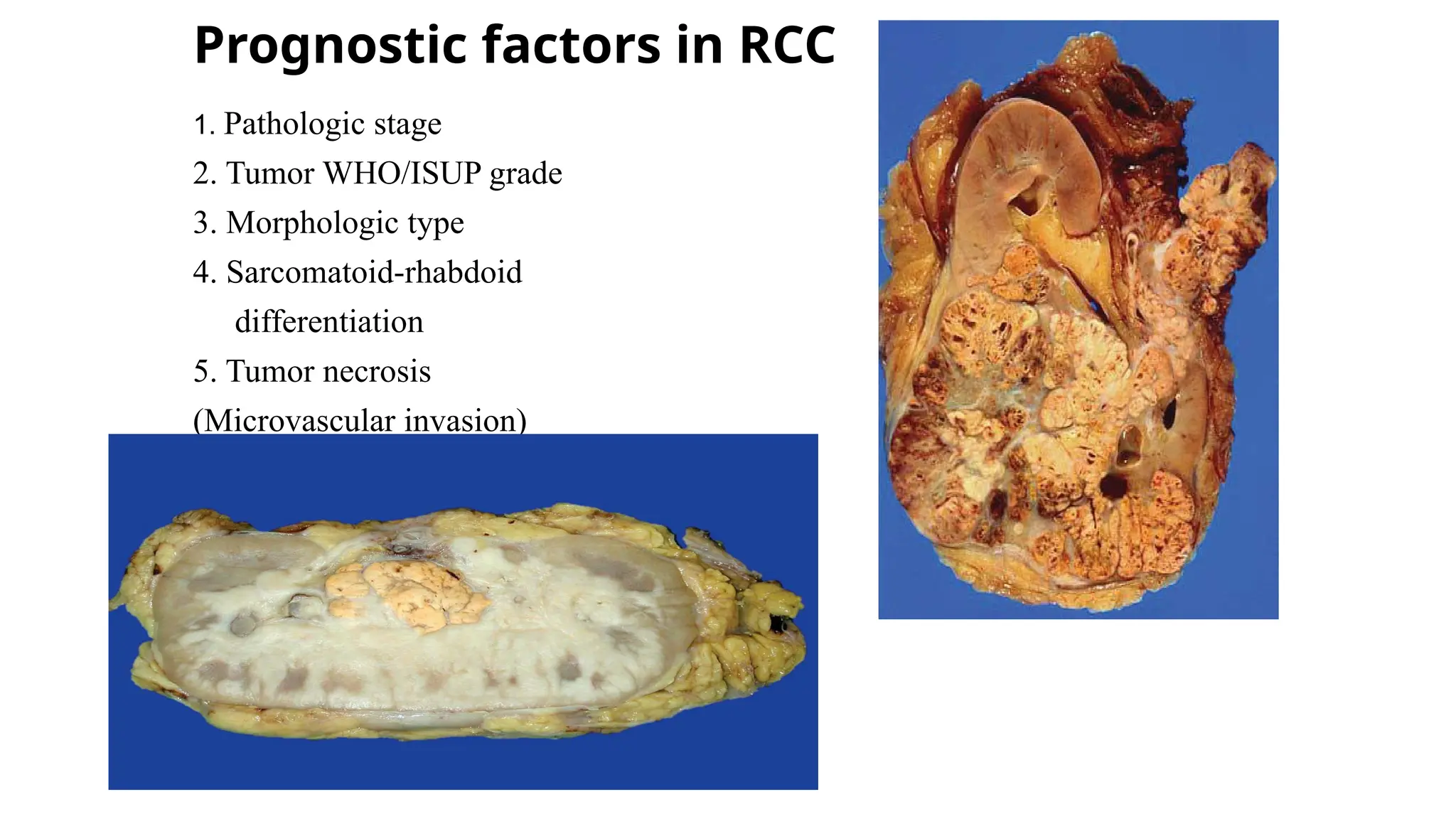 GROSSING OF KIDNEY.pptx, Anatomy and grossing | PPTX