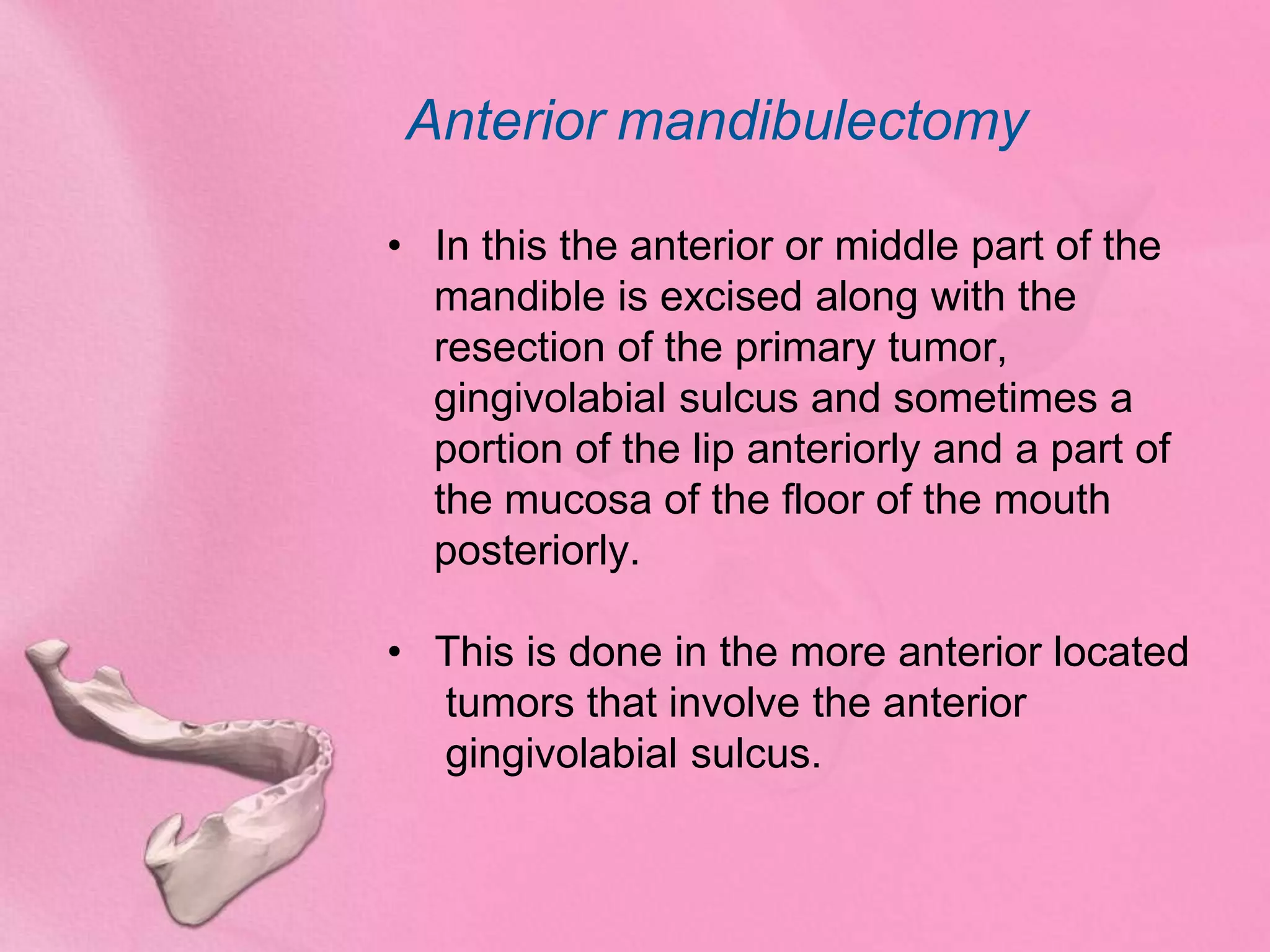 Grossing of mandibulectomy specimen - Dr Pranav, MGIMS | PPTX