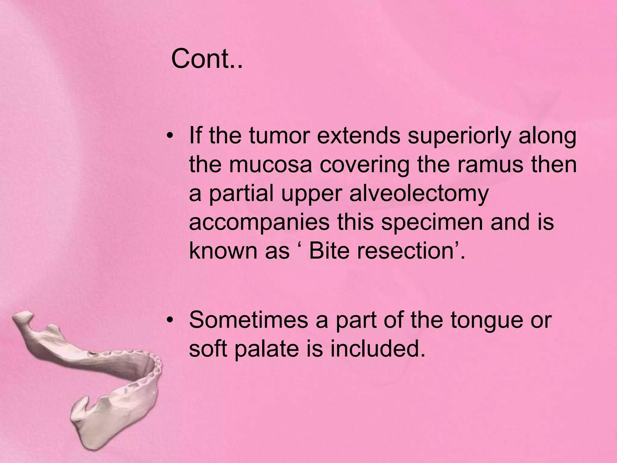 Grossing of mandibulectomy specimen - Dr Pranav, MGIMS | PPTX