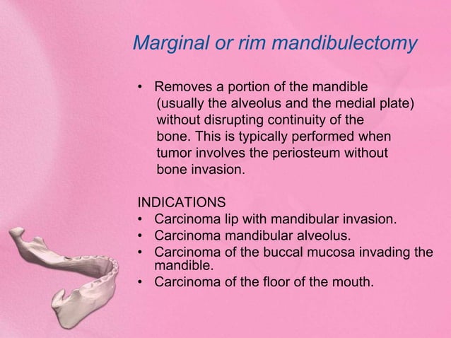 Grossing of mandibulectomy specimen - Dr Pranav, MGIMS | PPTX