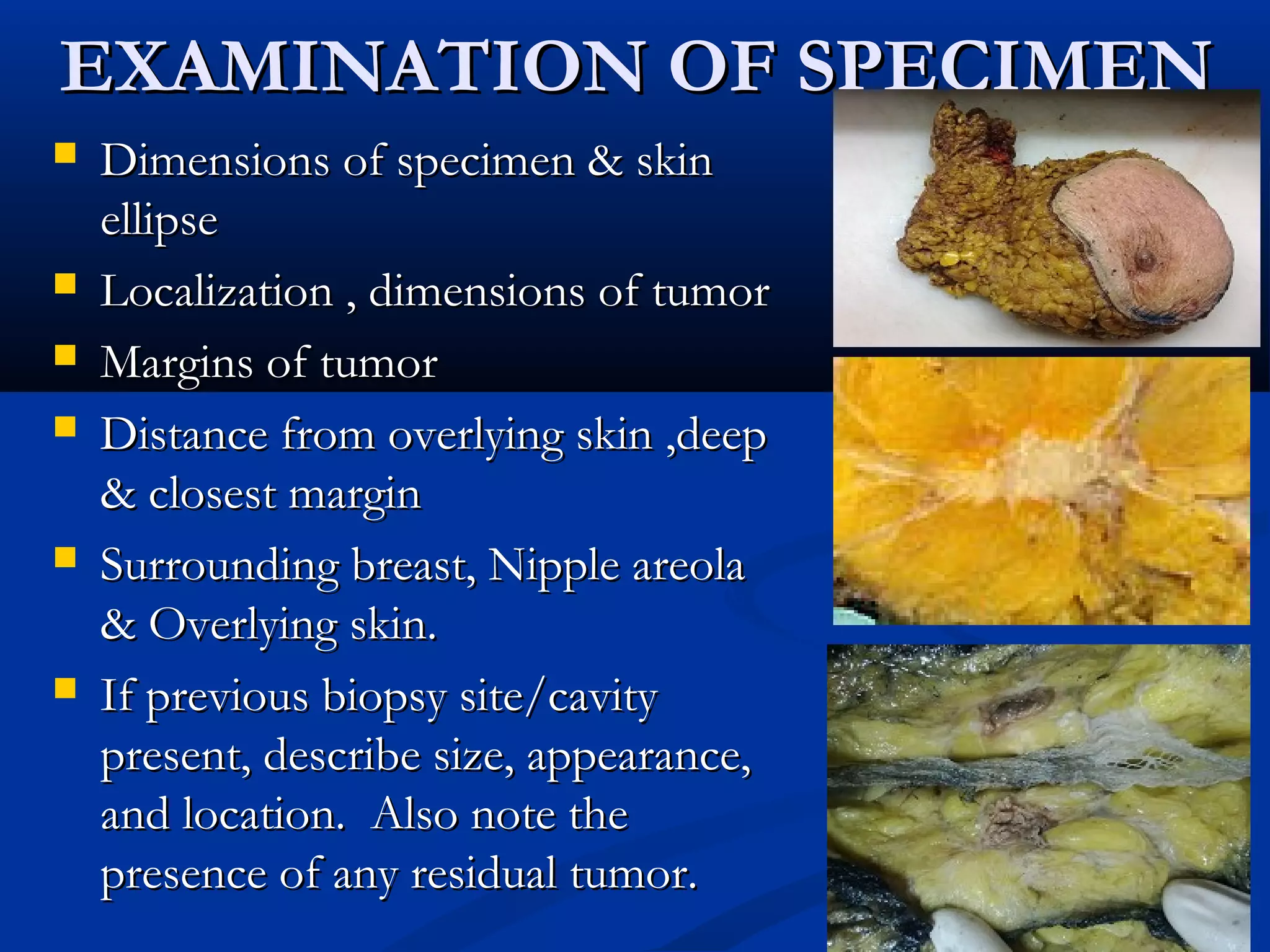 Grossing of breast specimens.pptmain | PPT