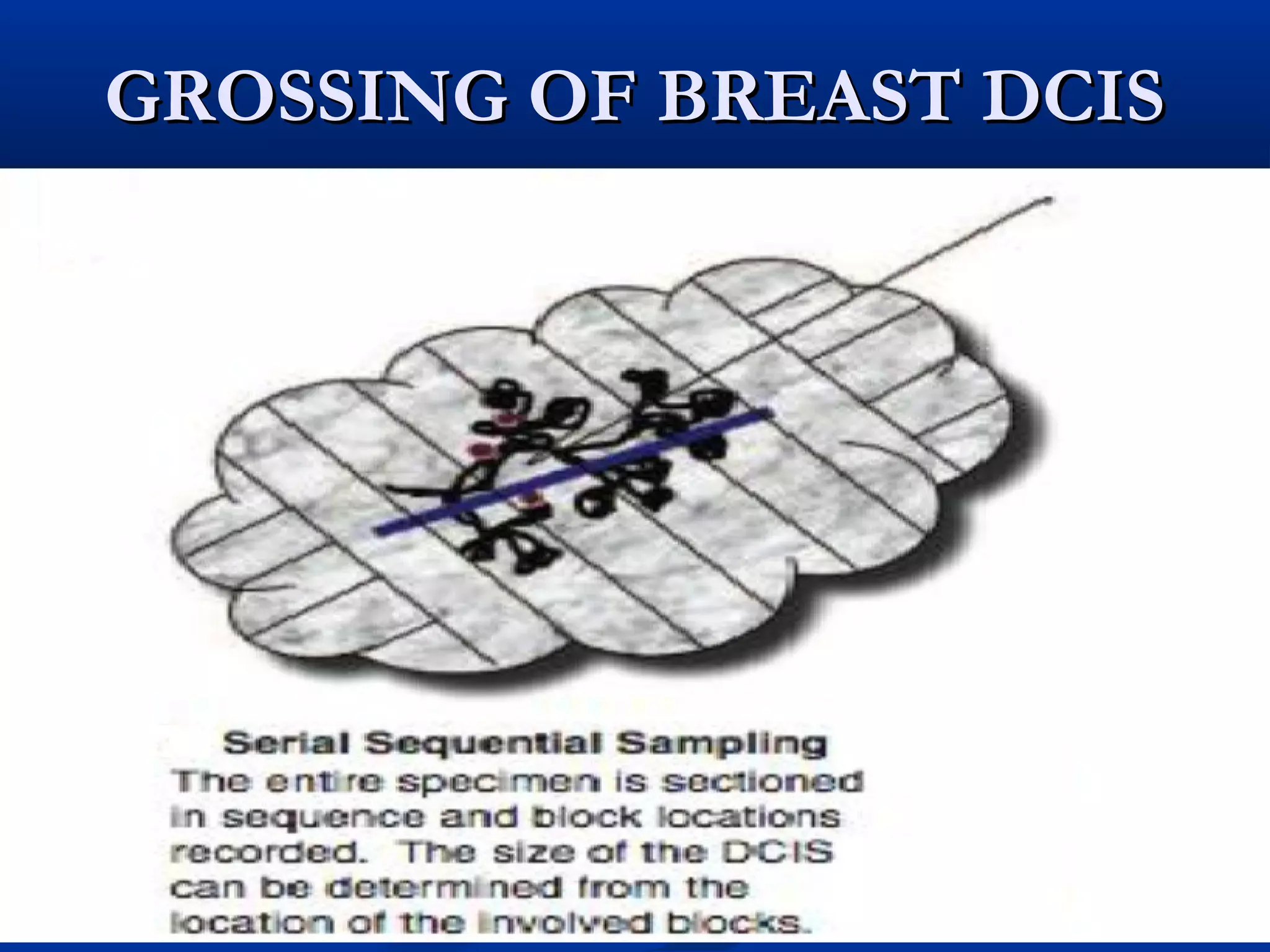 Grossing of breast specimens.pptmain | PPT