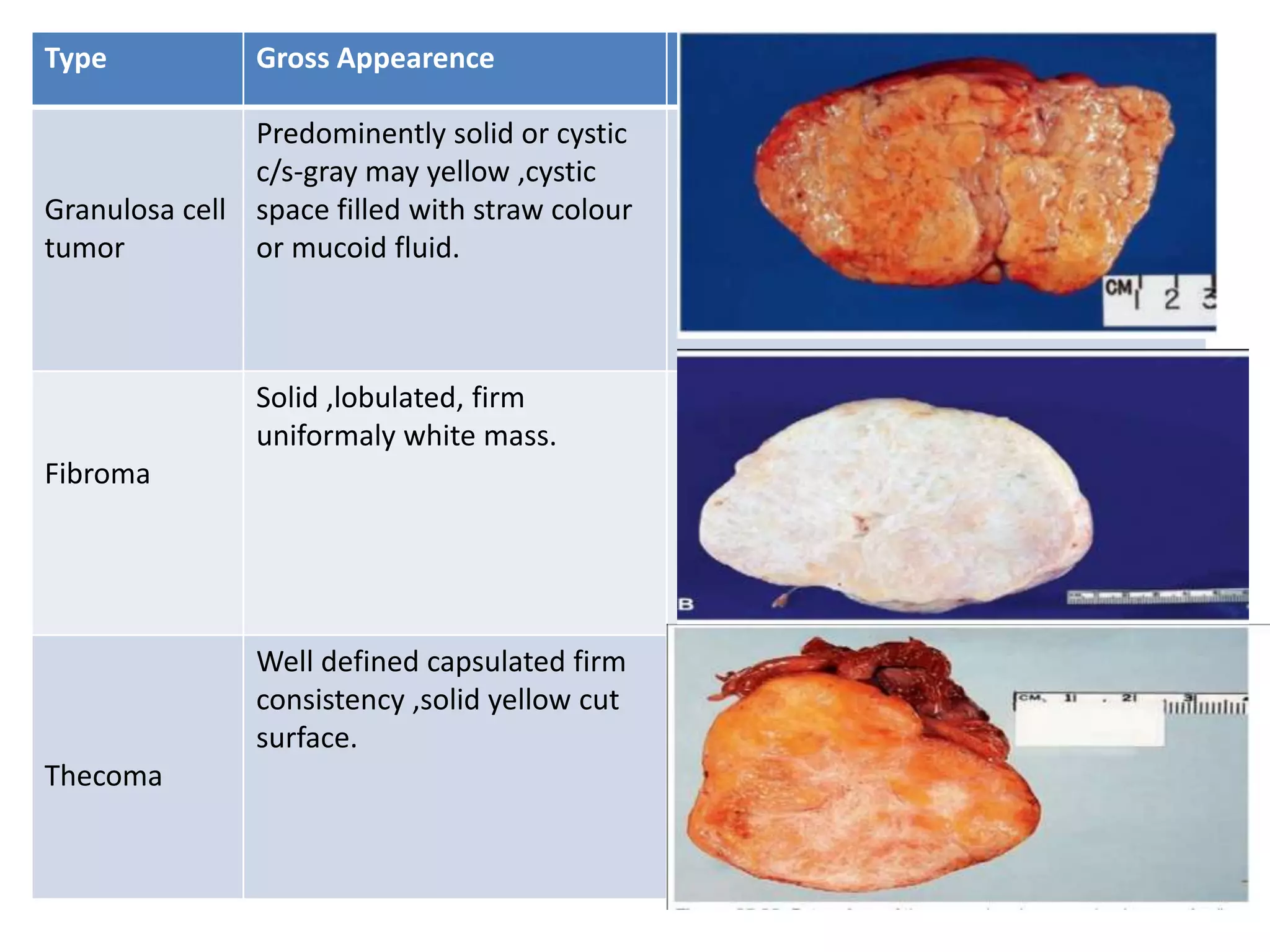 grossing of ovarian tumors.pptx