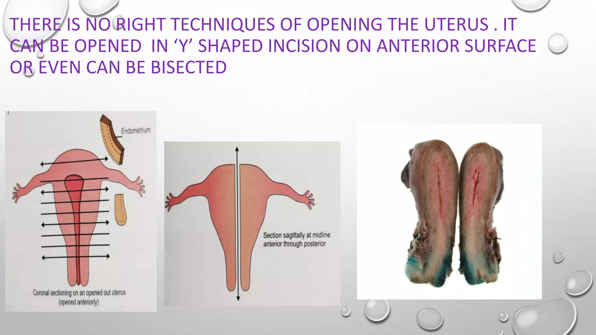 Histopath Grossing of uterus cervix &ovary | PPTX
