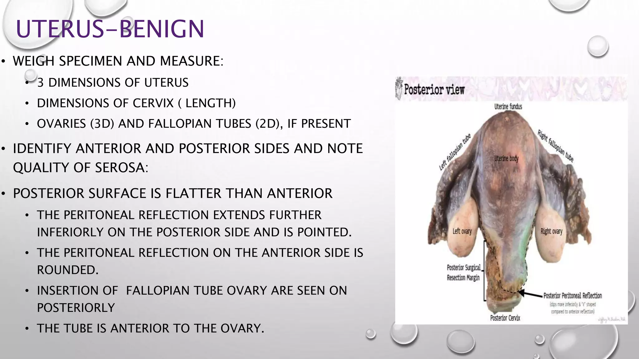 Histopath Grossing of uterus cervix &ovary | PPTX