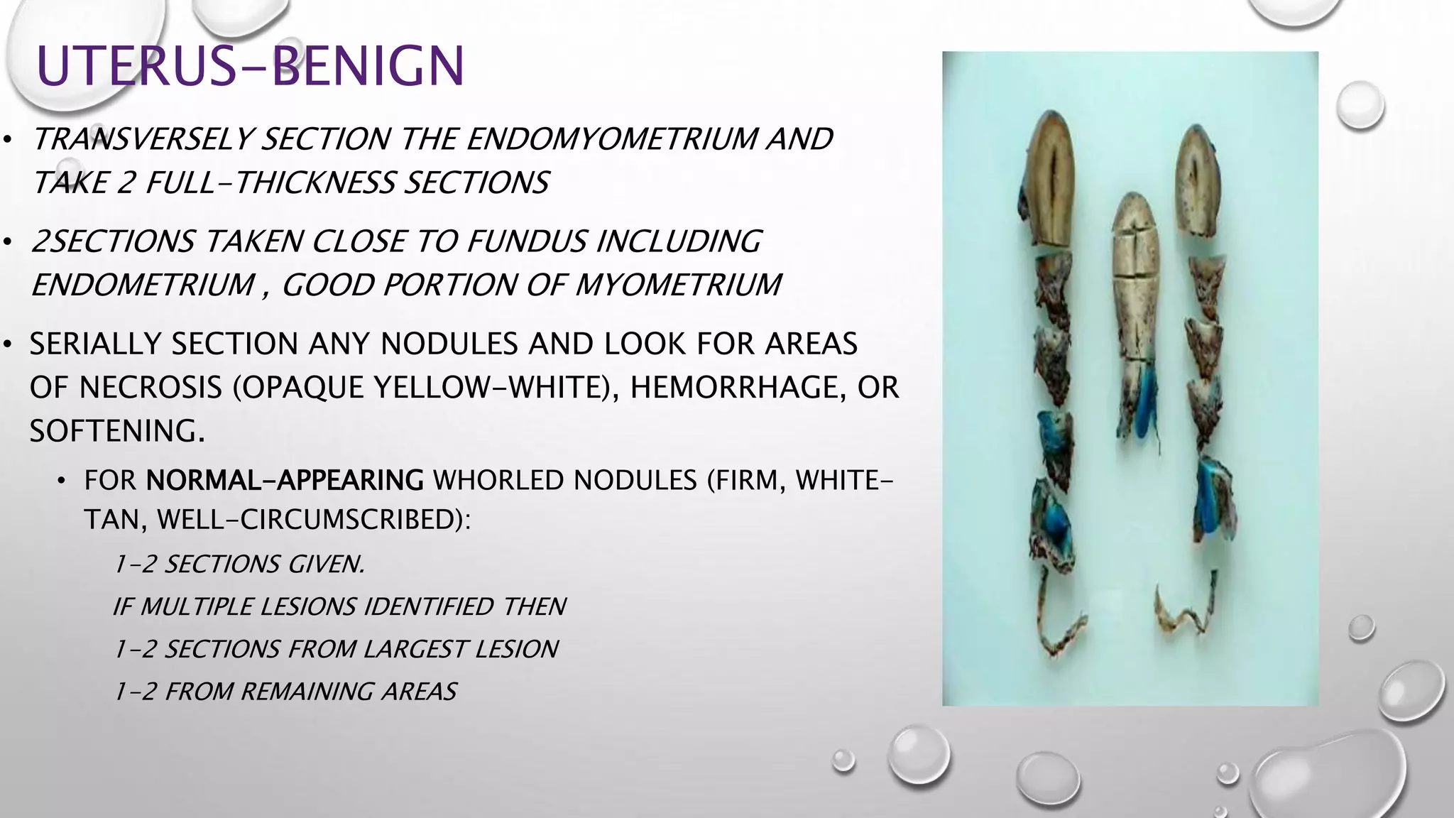 Histopath Grossing of uterus cervix &ovary | PPTX