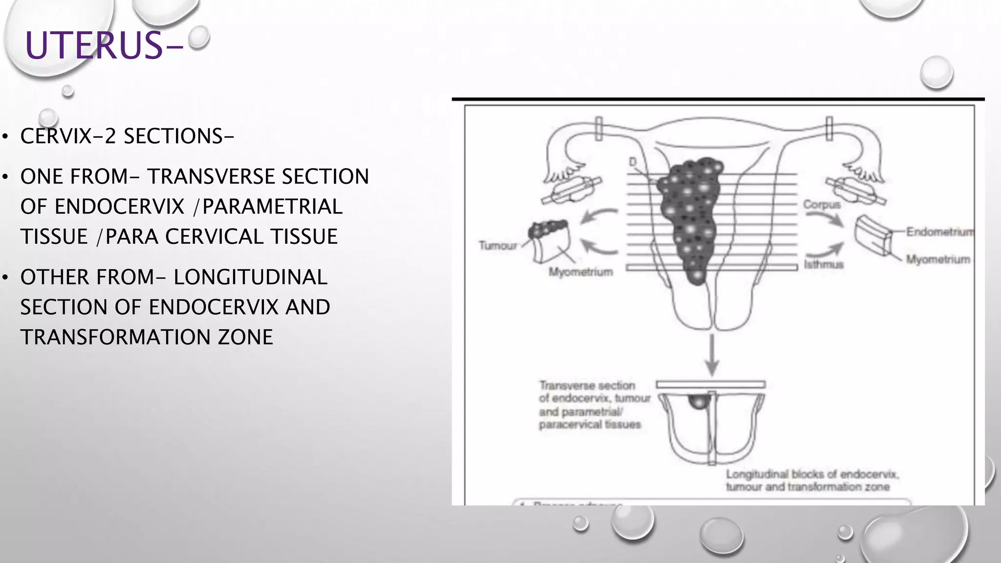 Histopath Grossing of uterus cervix &ovary | PPTX