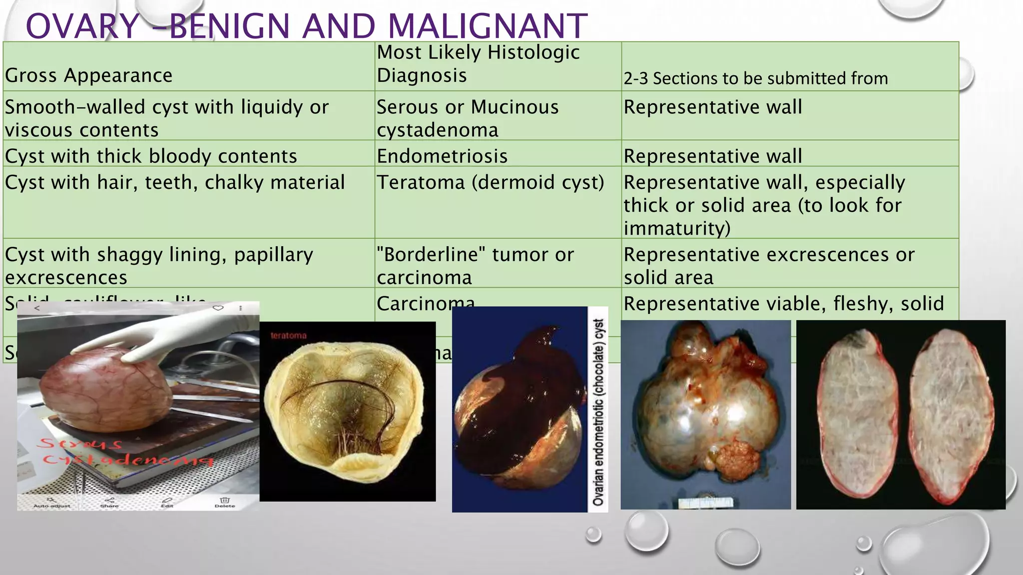 Histopath Grossing of uterus cervix &ovary | PPTX