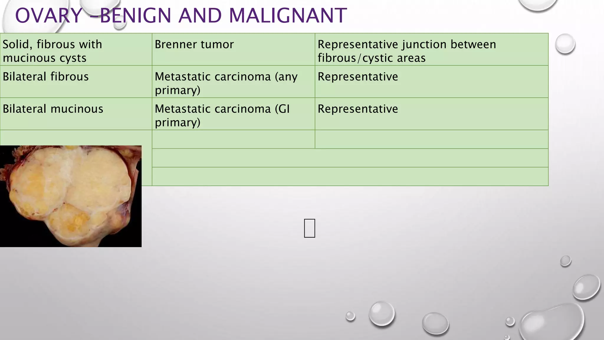 Histopath Grossing of uterus cervix &ovary | PPTX