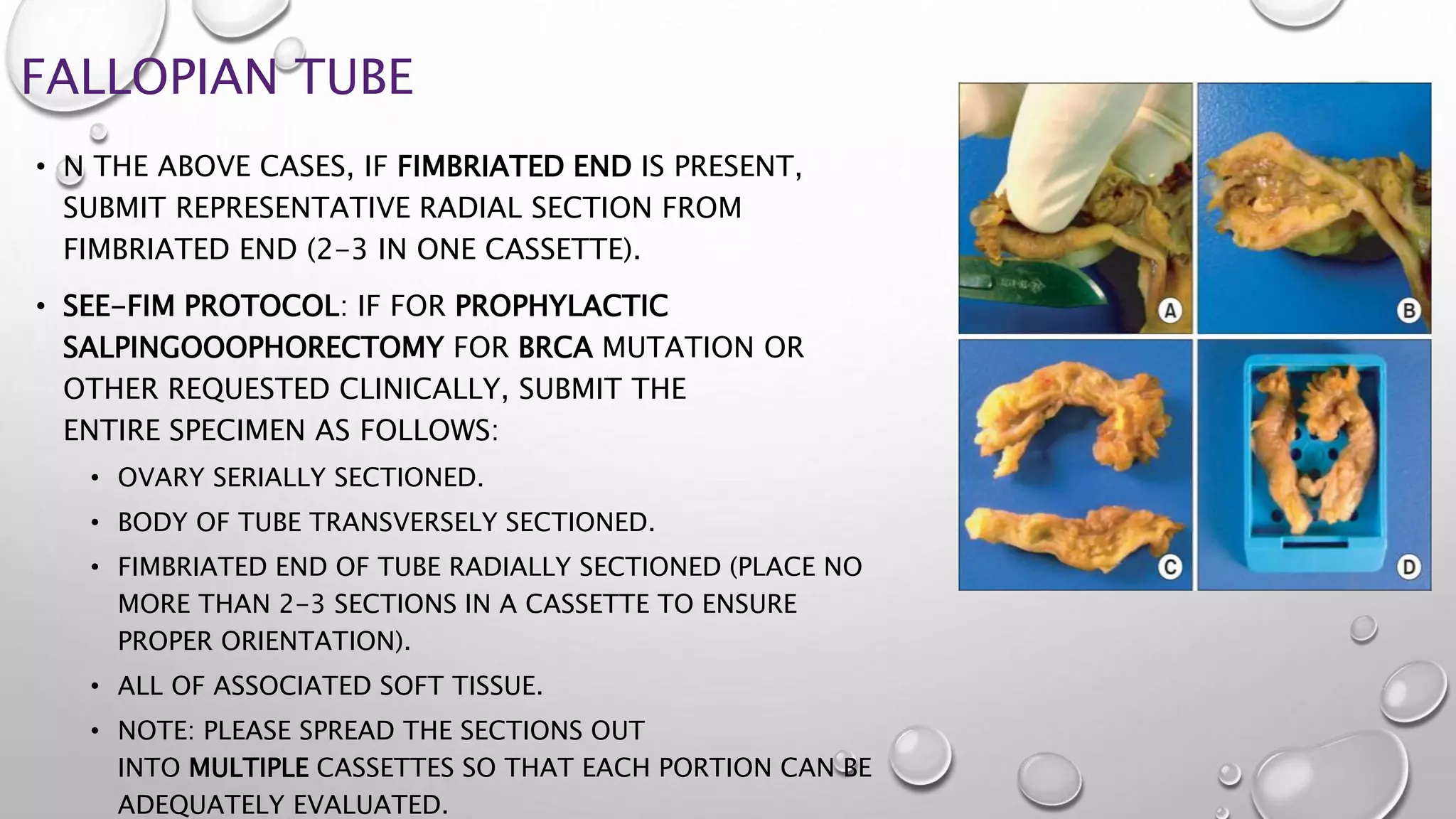 Histopath Grossing of uterus cervix &ovary | PPTX