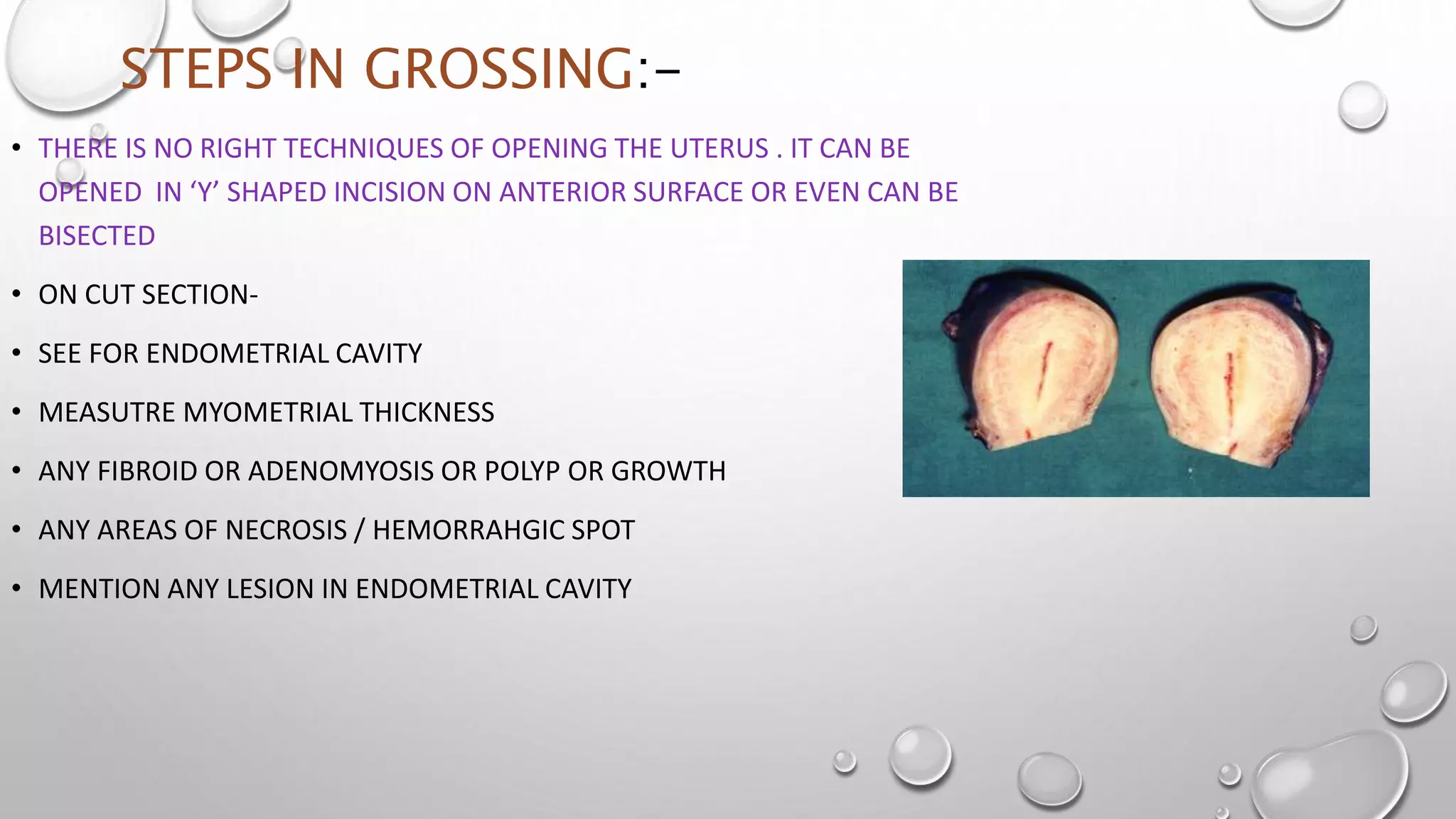 Histopath Grossing of uterus cervix &ovary | PPTX