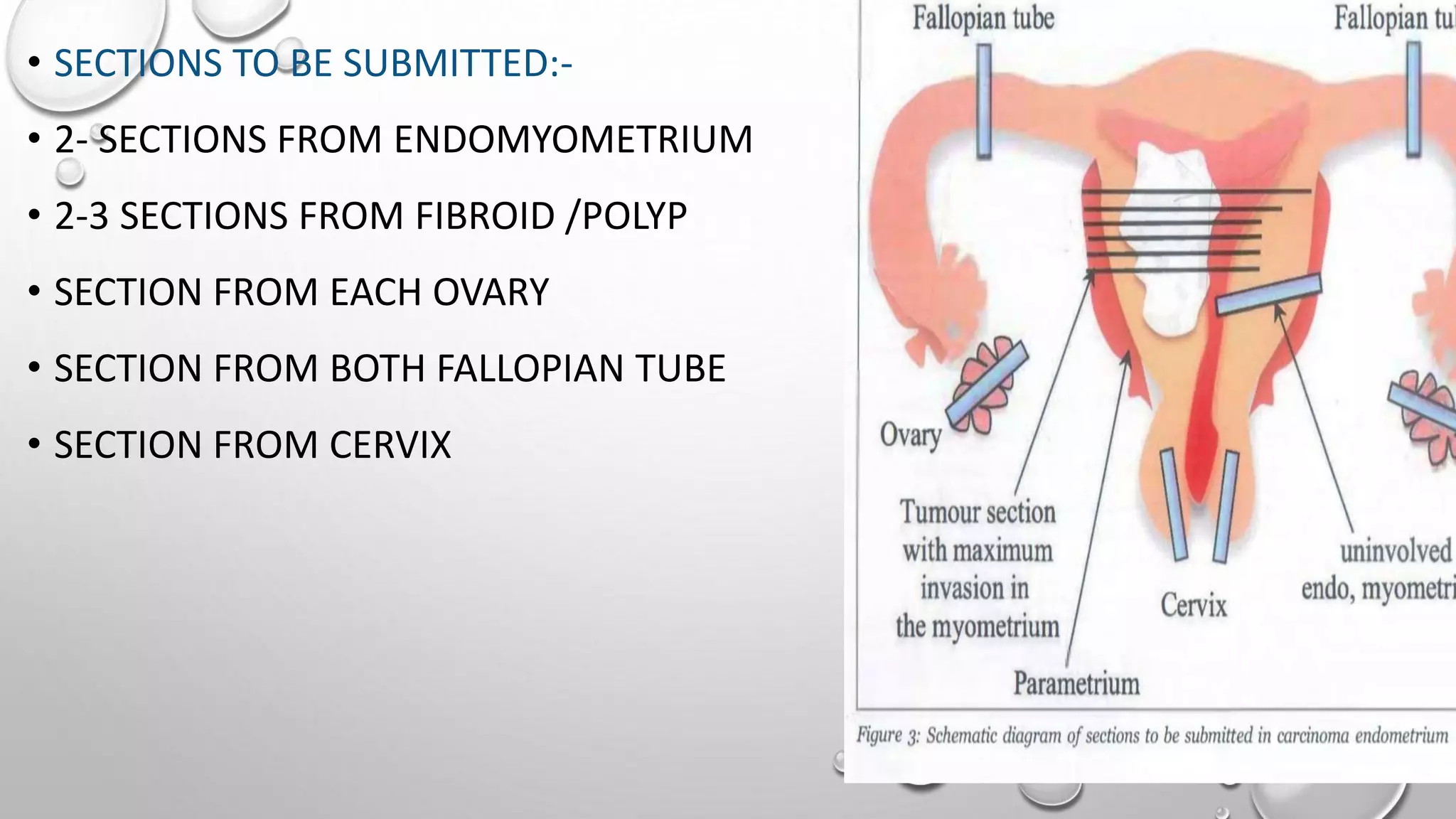 Histopath Grossing of uterus cervix &ovary | PPTX