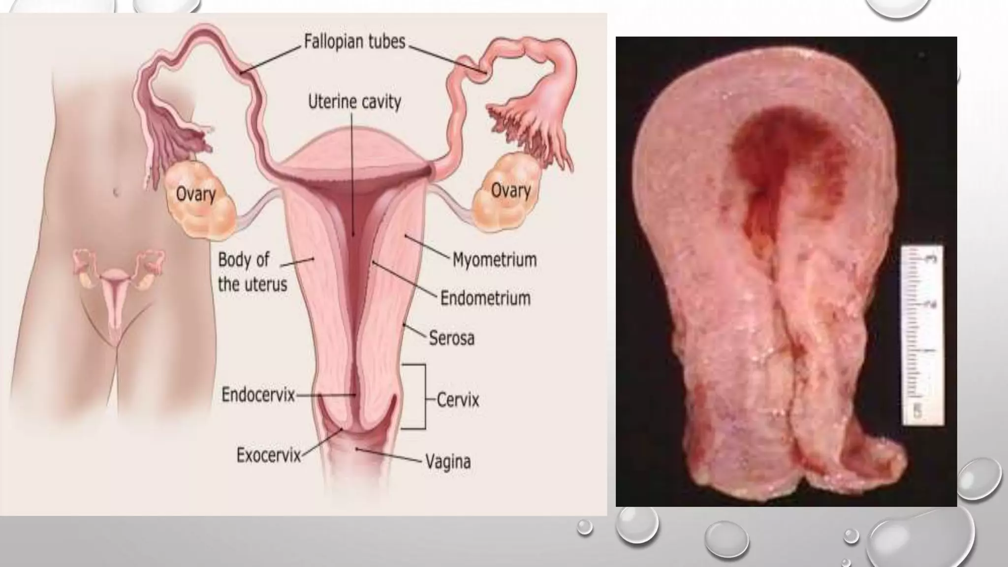 Histopath Grossing of uterus cervix &ovary | PPTX
