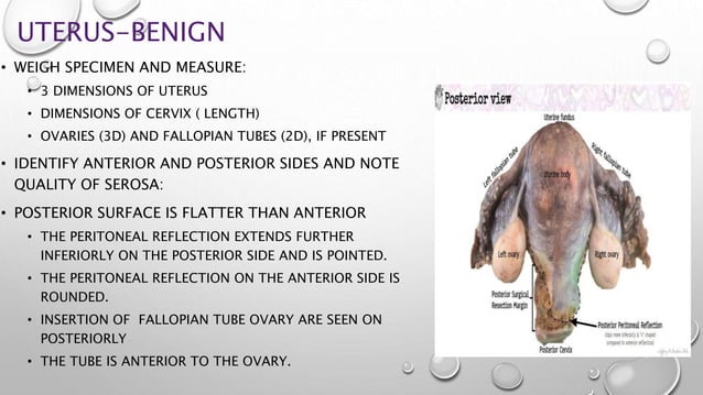 Histopath Grossing of uterus cervix &ovary | PPTX