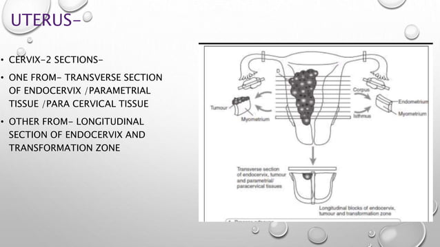 Histopath Grossing of uterus cervix &ovary | PPTX