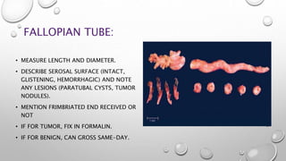 Histopath Grossing of uterus cervix &ovary | PPTX