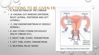 Histopath Grossing of uterus cervix &ovary | PPTX
