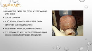 Histopath Grossing of uterus cervix &ovary | PPTX