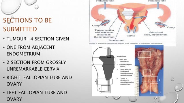 Histopath Grossing of uterus cervix &ovary | PPTX